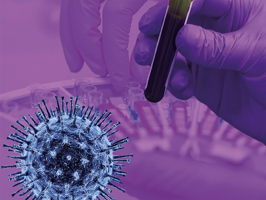 Epidemien, Pandemien, Endemien – MedienLB